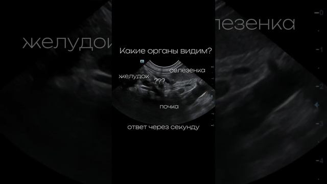 Как понять, что видно на УЗИ? Анатомические ориентиры. Обучение УЗИ для ветврачей. Сайт в описании