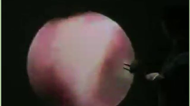 Доктор Симончини. 1 часть.