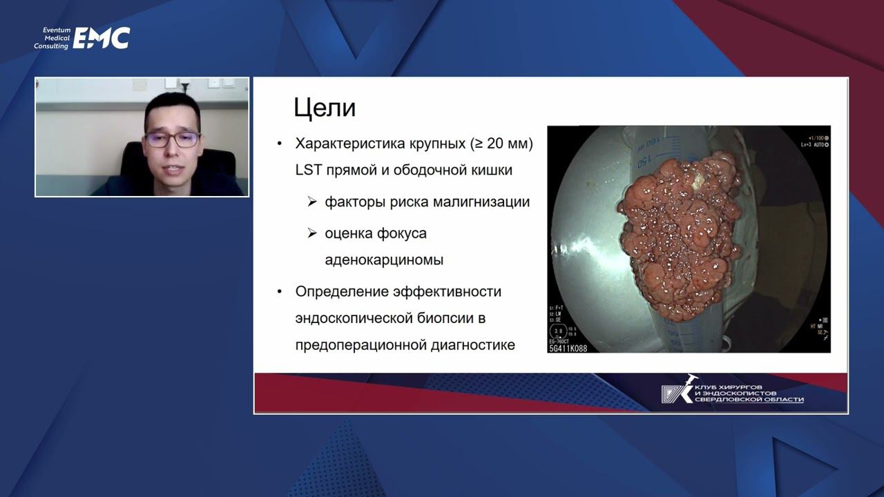9. Диагностическая ценность предоперационной эндоскопической биопсии  — Ким Сергей Игнатьевич