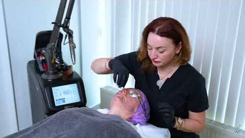 Процедура легендарного карбонового пилинга на аппарате HOLLYWOOD LASER PELL