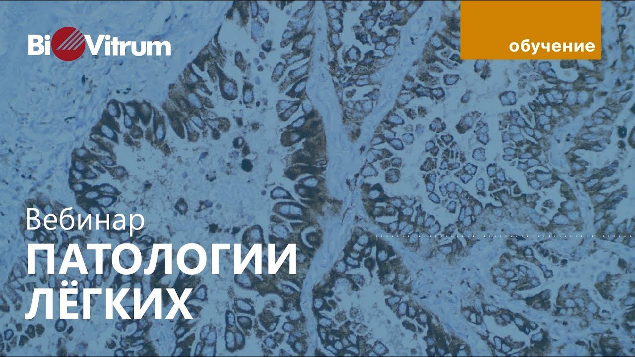 Вебинар "Обзор патологий легких"