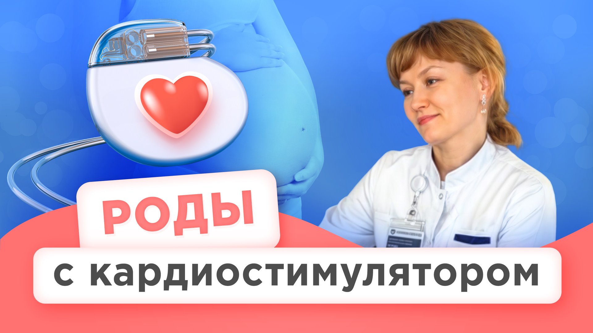 Роды и беременность с кардиостимулятором — особенности