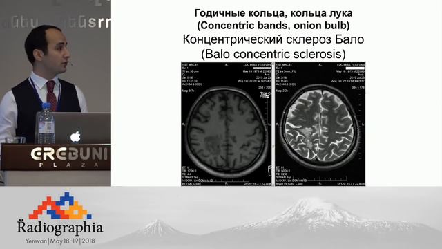 Частицы природы в радиологии. Нарек Матинян