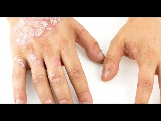 Проблемы  с кожей (ч.2)