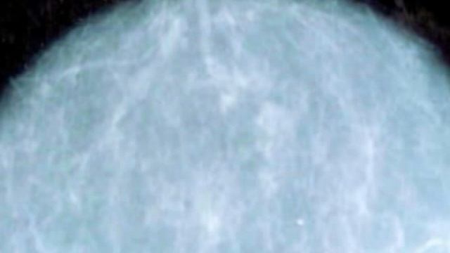 Замедление роста опухоли - Больше чем ФАКТЫ О ПИТАНИИ - Майкл Грегер