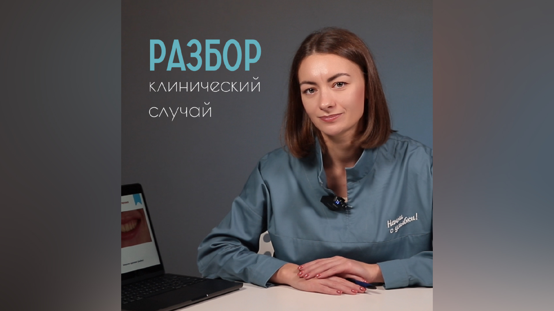 РАЗБОР случая: ставим в зубной ряд дистопированные клыки, убираем глубокое перекрытие спереди