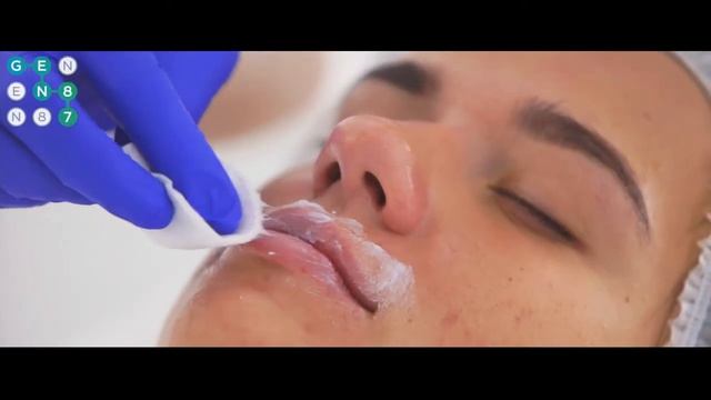 УВЕЛИЧЕНИЕ ГУБ, КОРРЕКЦИЯ ФОРМЫ И ОБЪЕМА ГУБ Сеть клиник косметологии GEN87