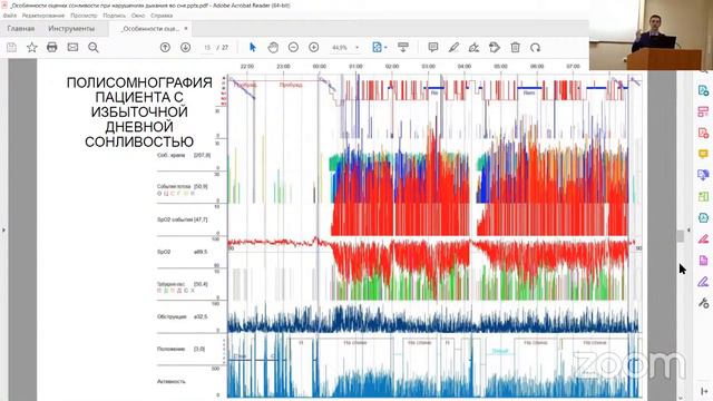 Особенности оценки сонливости при нарушениях дыхания во сне