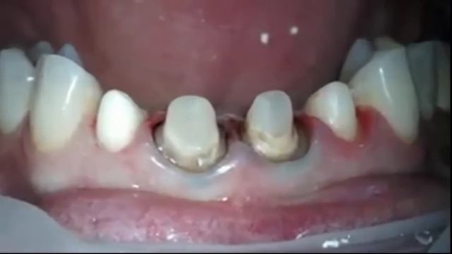 Дмитрий Компаниец. Кейс работы с Variotime