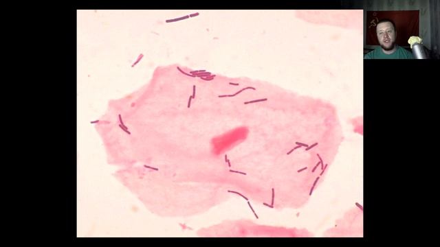 Введение в микробиологию. Часть 7. Систематика. Извитые, молочнокислые, споры
