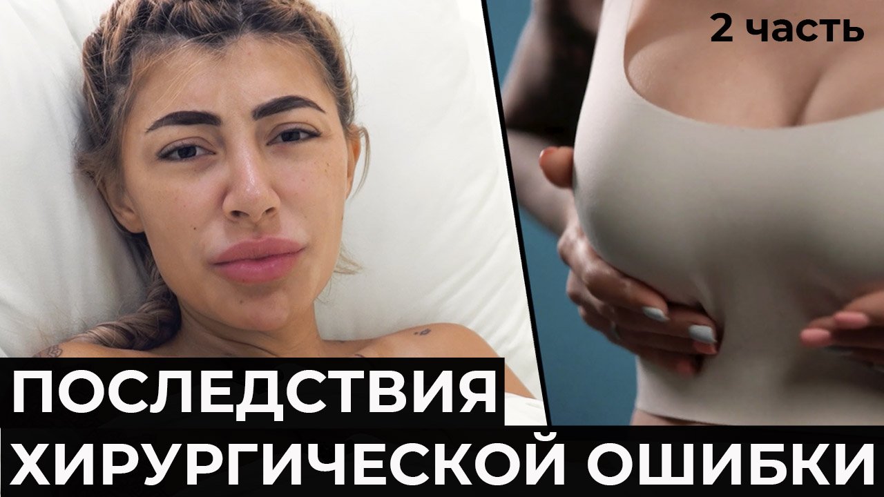 ТАТА История чужой хирургической ошибки и ее последствия. 2 часть. Блохин Сергей Николаевич.