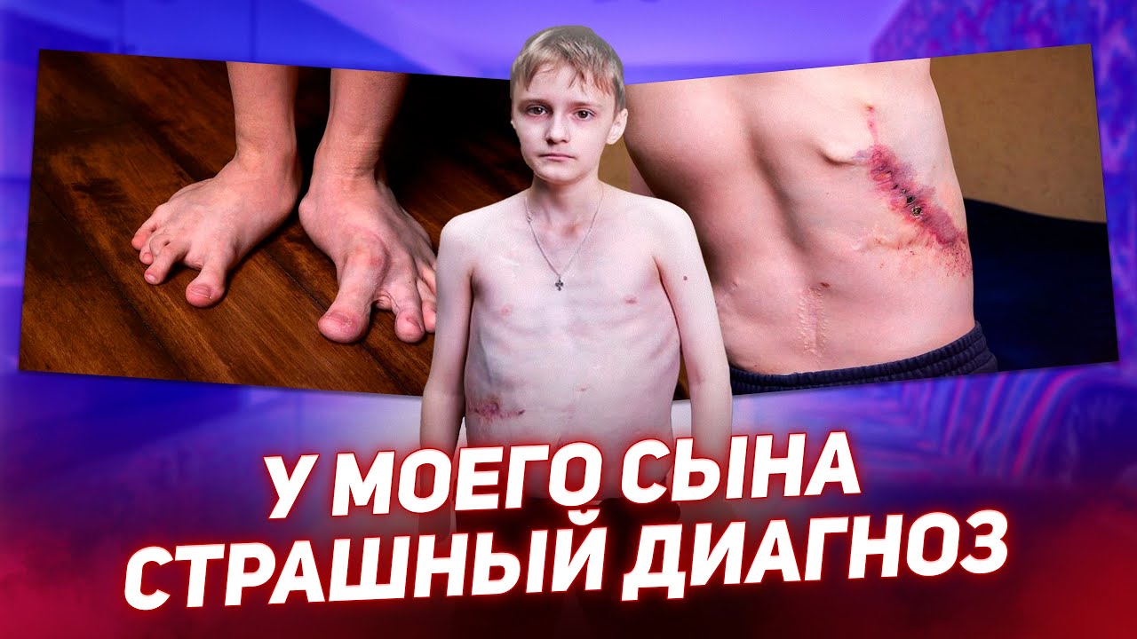 У МОЕГО СЫНА СТРАШНЫЙ ДИАГНОЗ
