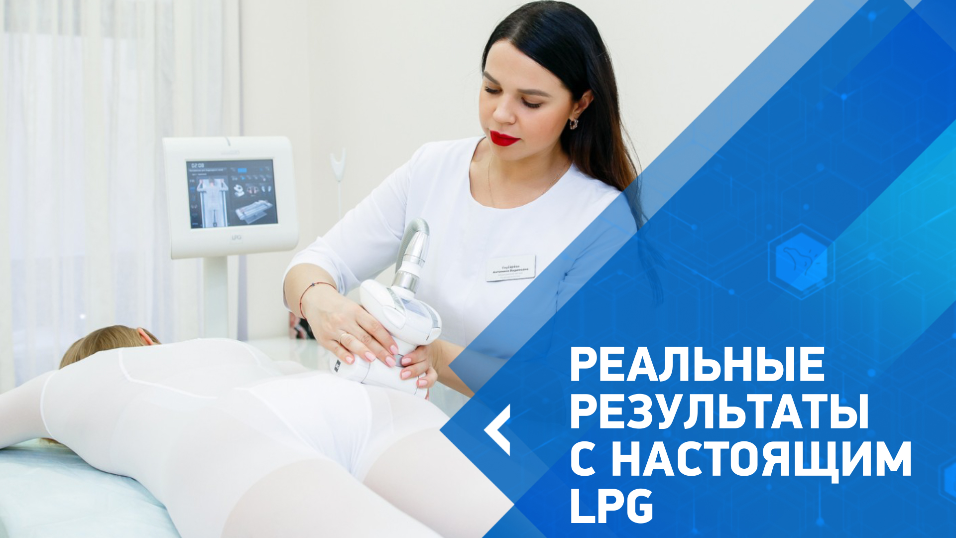 Реальные результаты с настоящим LPG