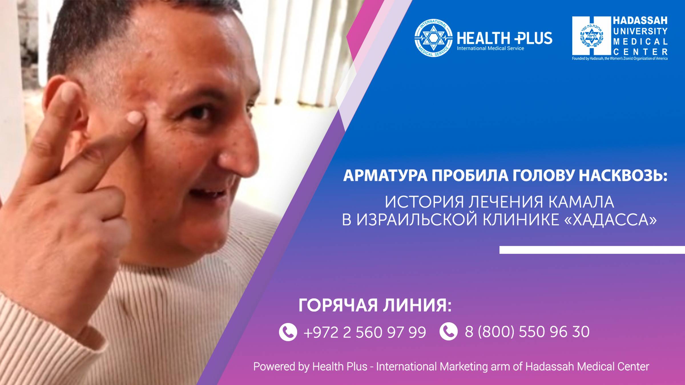 Арматура пробила голову насквозь: история Камала