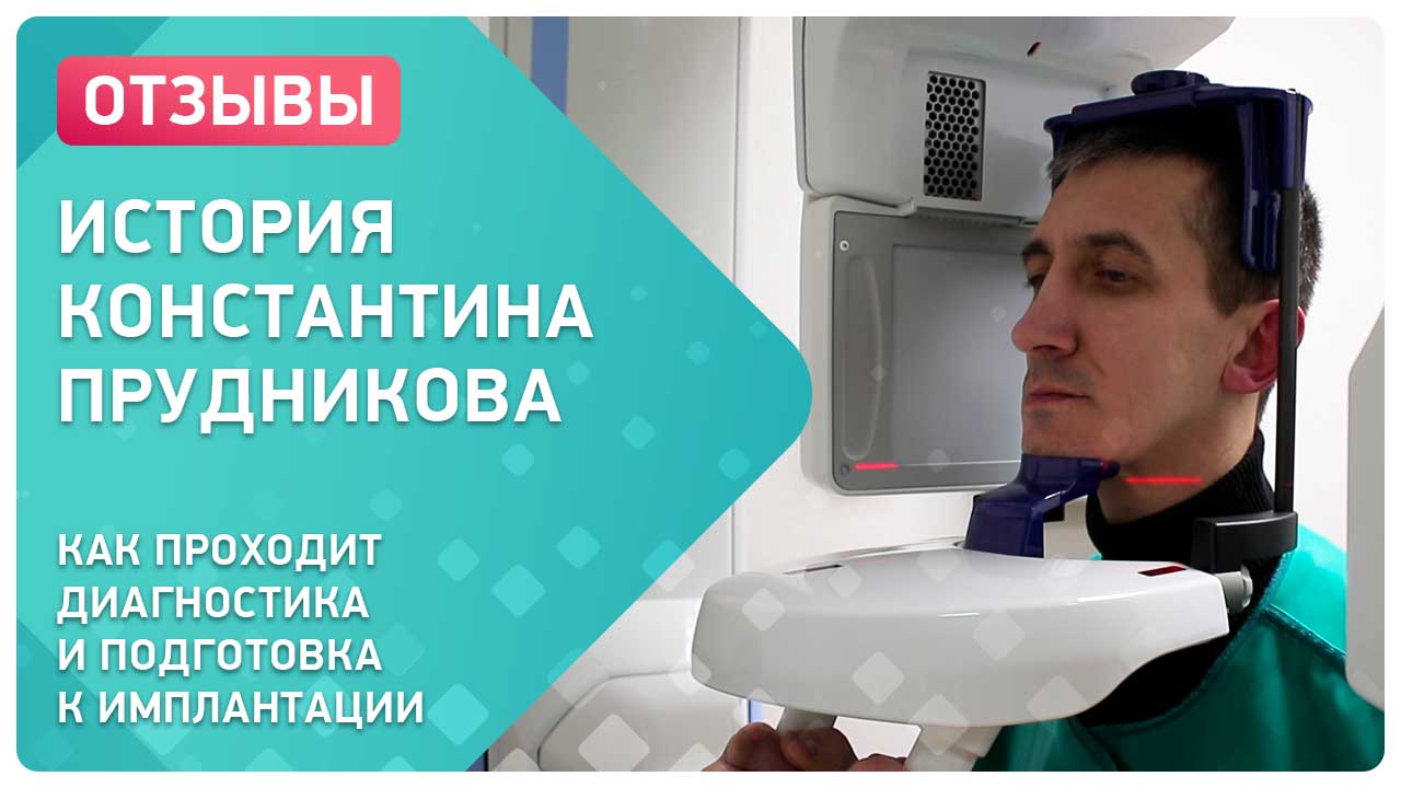 Какие процедуры нужно обязательно пройти при подготовке к имплантации зубов?