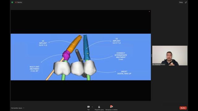 ФЕДЕРИКО РИВАРА,  Federico Rivara (DDS, MS  - "Продвинутый курс - вебинар по навигационной хирургии"