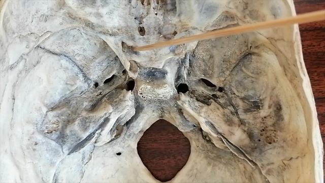 I, II и VIII пары черепно-мозговых нервов