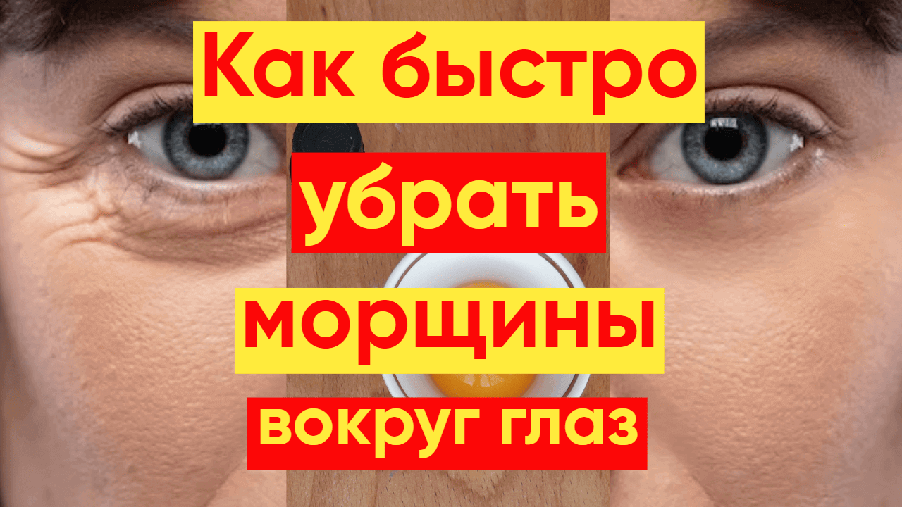 УБРАТЬ МОРЩИНЫ ВОКРУГ ГЛАЗ - 5 ЛУЧШИХ РЕЦЕПТОВ!