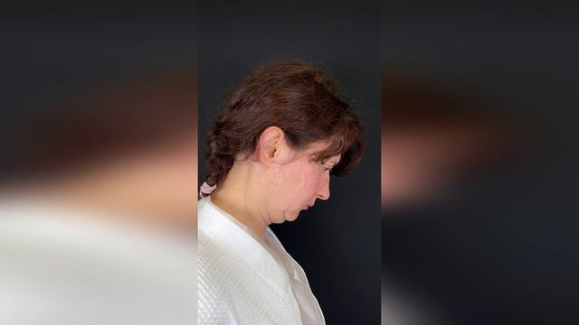 Осмотр перед пластикой лица