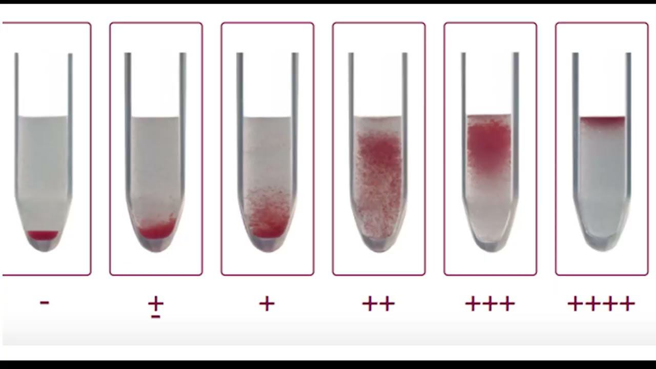 Определение группы крови AB0, антигенов системы Rh и Kell гелевым методом (тест-системы Biorad)