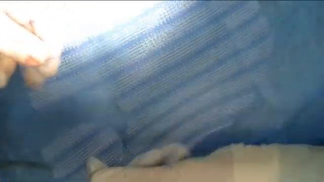 Комбинированная пластика при ПОВГ.mp4