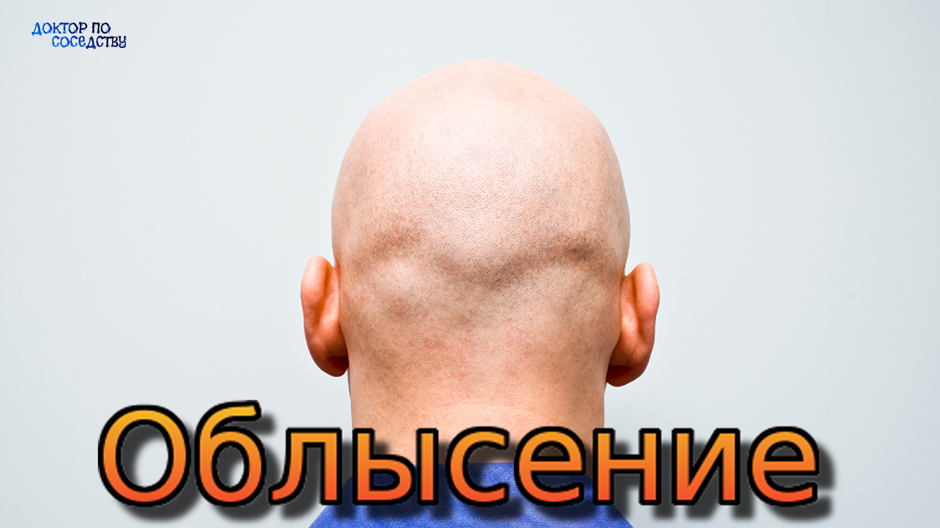 Лечение облысения. Доктор по соседству.