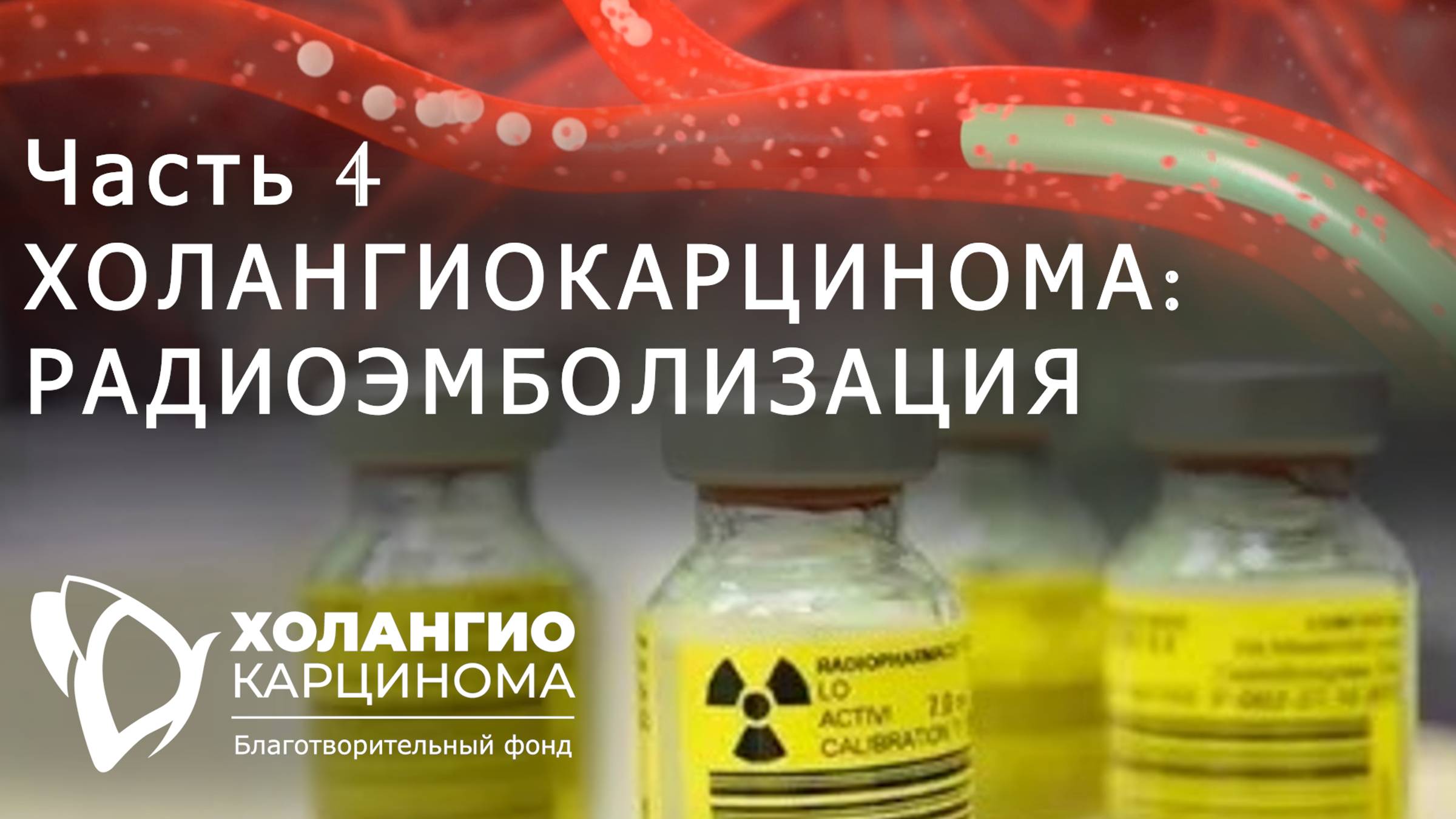 ЧАСТЬ 4. ХОЛАНГИОКАРЦИНОМА: РАДИОЭМБОЛИЗАЦИЯ // МАЛОИНВАЗИВНЫЕ МЕТОДЫ ПРОТИВООПУХОЛЕВОГО ЛЕЧЕНИЯ