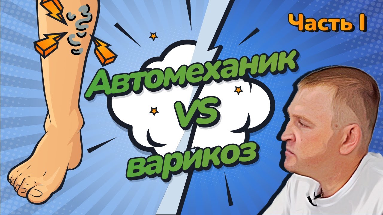 АВТОМЕХАНИК VS ВАРИКОЗ Часть I