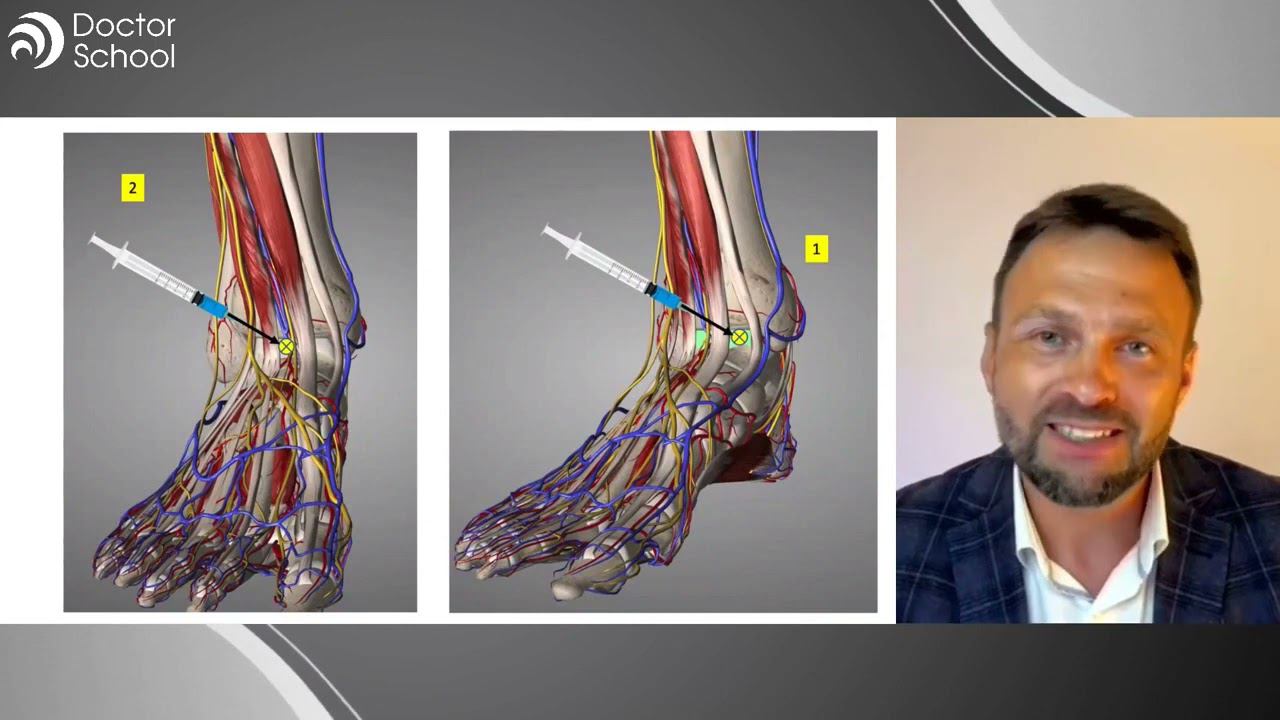 Фрагмент вебинара Артроскопия голеностопного сустава.