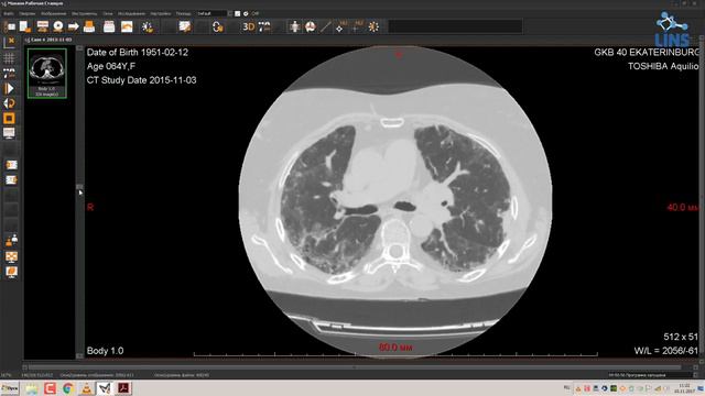 Дифференциальный диагноз в торакальной радиологии. Павел Коротков