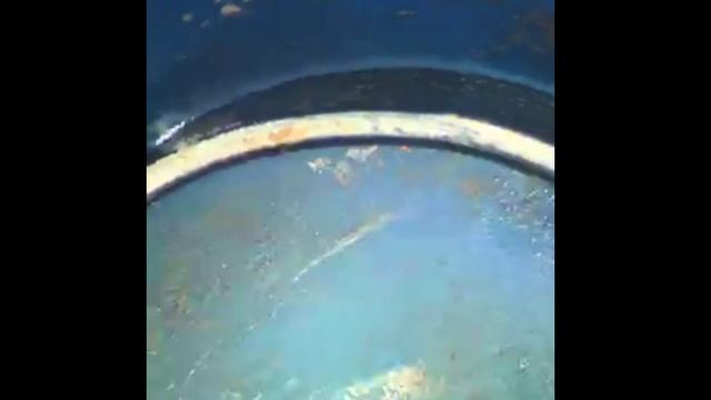 2020-06-12 Бессимптомный резорциненый зуб.