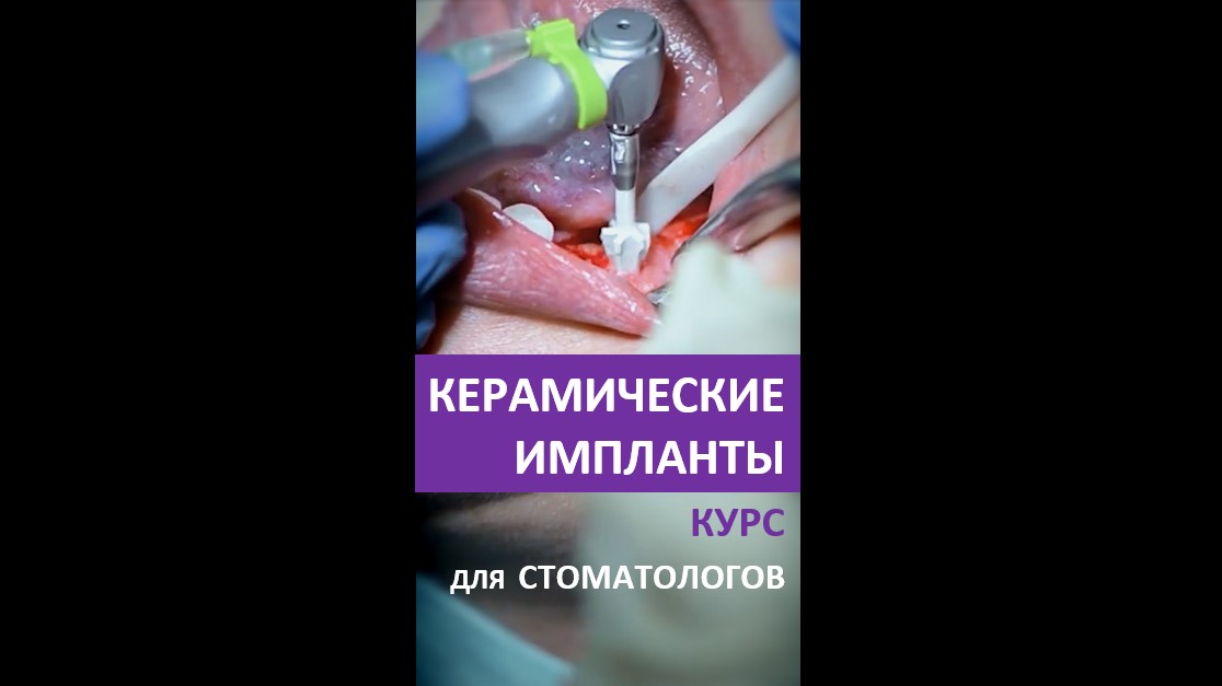 Керамические импланты. Съемка и монтаж ВИДЕО в вертикальном формате для стоматологии