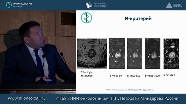 МРТ в диагностике рака прямой кишки