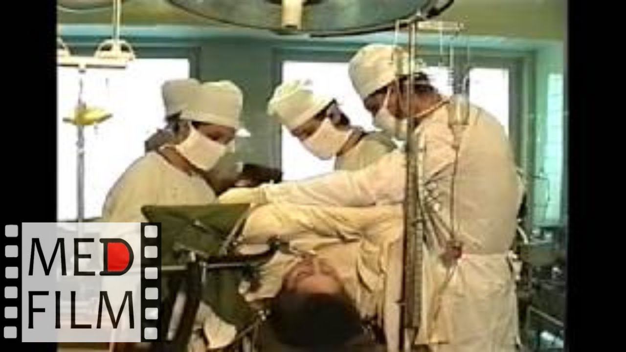 Протезирование митрального клапана © Mitral valve replacement