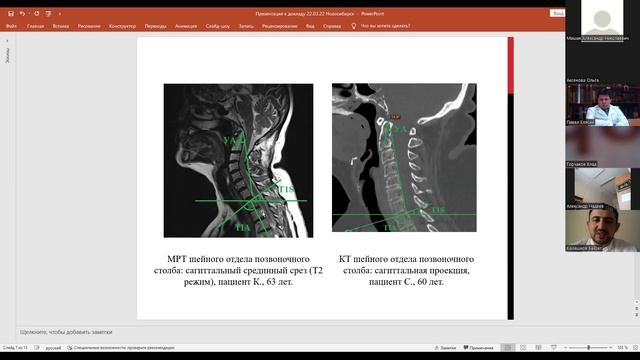 Калашаов Б.М. "Анатомическая вариабельность шейного отдела позвоночного столба по данным МРТ и КТ"