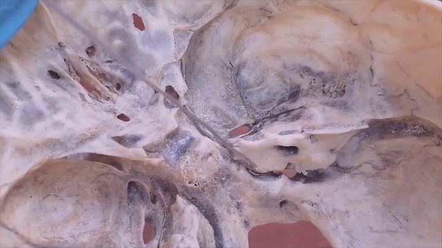 Височная и решетчатая кости. Каналы височной кости