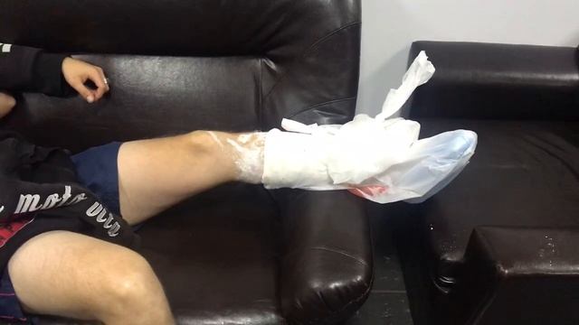 Андрюха сломал ногу