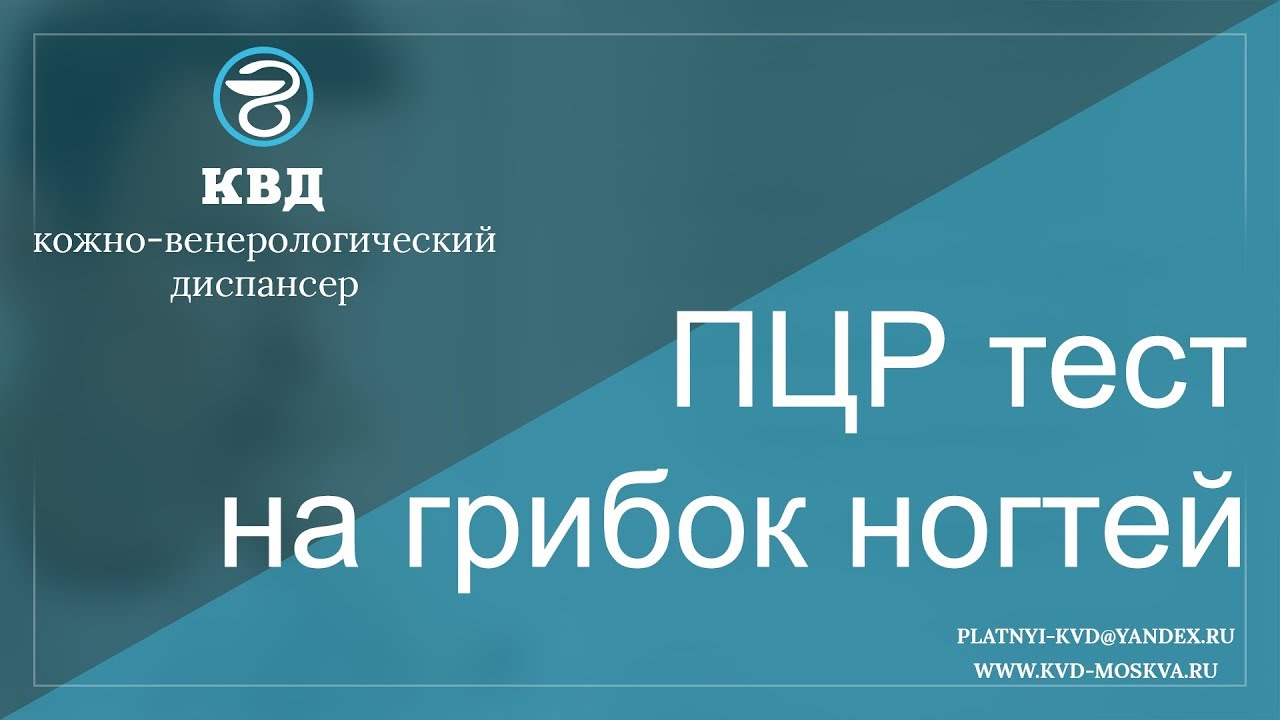276  ПЦР тест на грибок ногтей