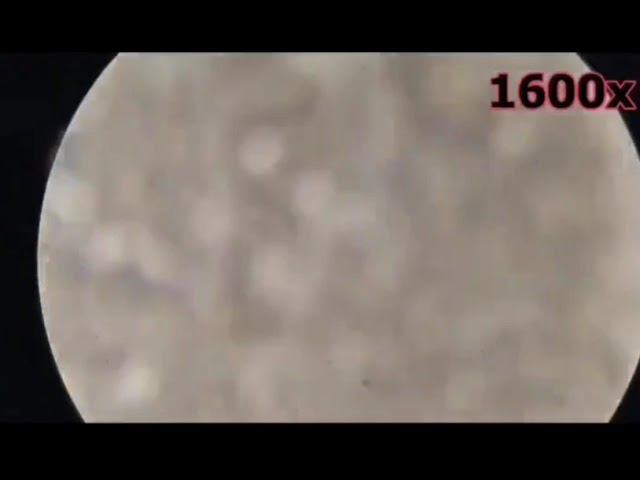 Что кофе делает с кровью? Как разжижать - в описании к видео