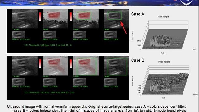 3D vector analysis of 2D ultrasound diagnostic images