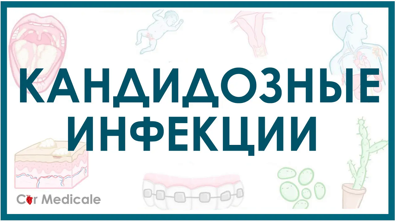 Кандидозные инфекции - кратко причины, симптомы, диагностика, лечение