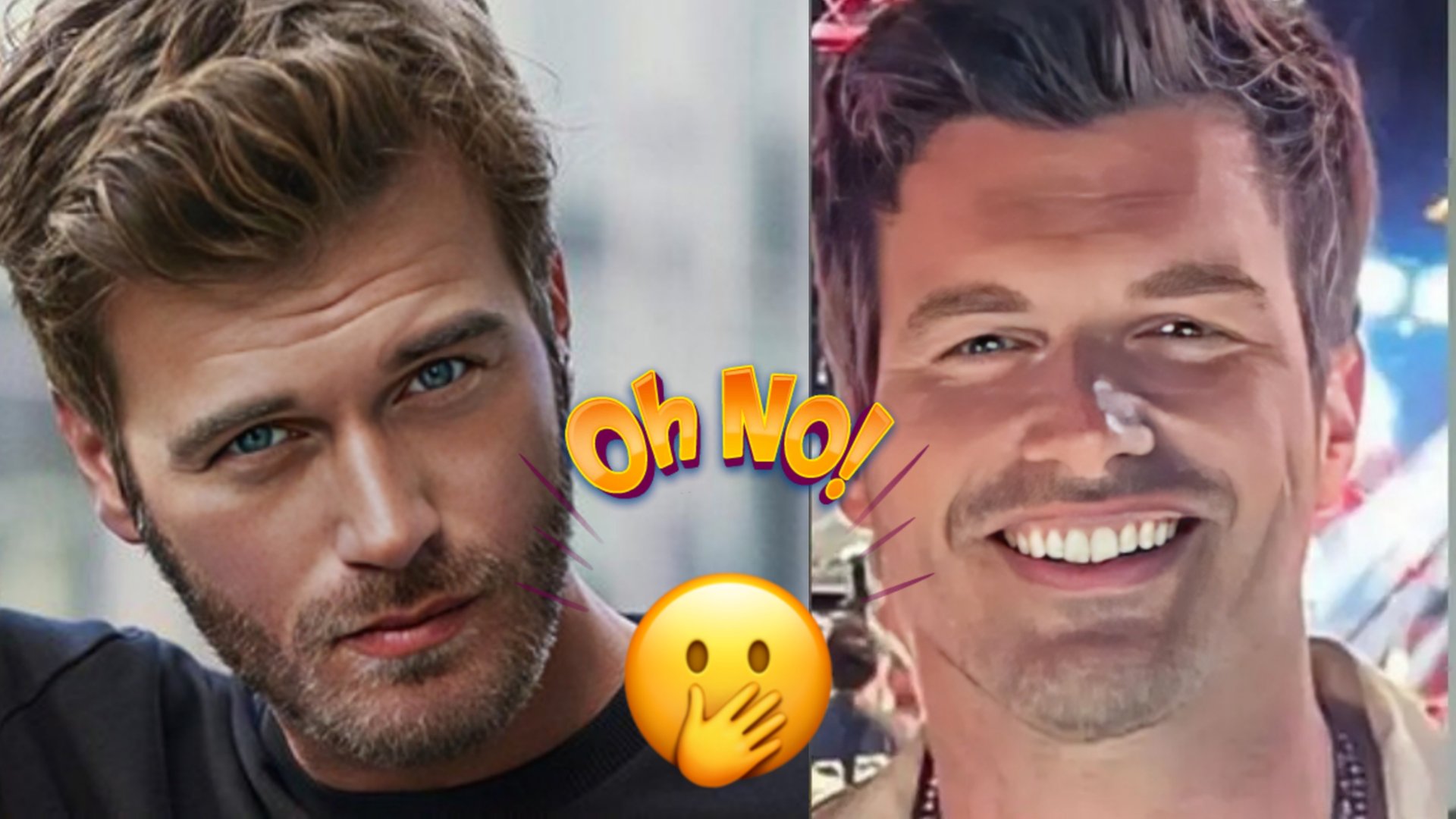 КЫВАНЧ ТАТЛЫТУГ СДЕЛАЛ ПЛАСТИЧЕСКУЮ ОПЕРАЦИЮ?🇹🇷