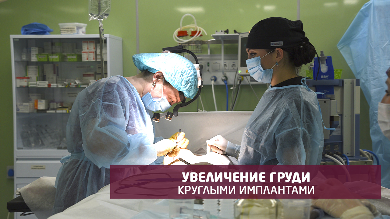 Увеличение груди круглыми имплантами. Пластический хирург Гогохия Тамара Зауровна.