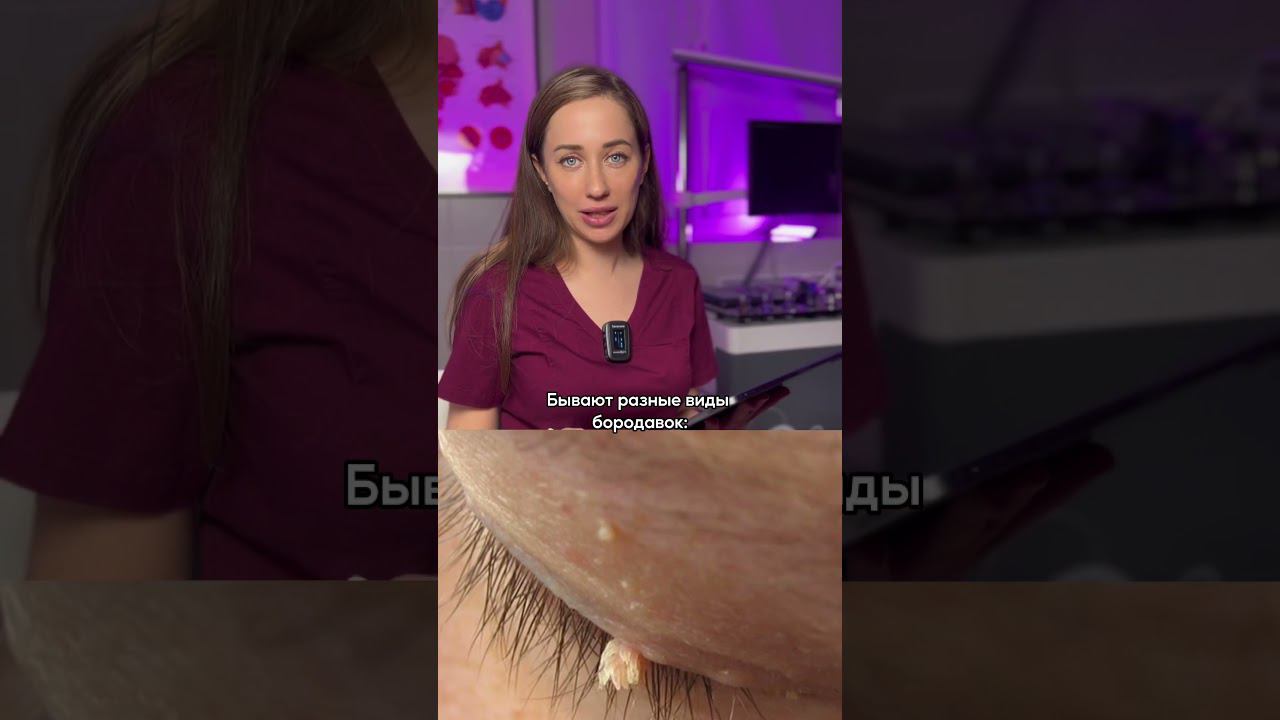 Бородавки у детей❗️ Откуда они берутся?