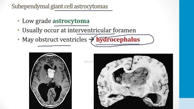 Дерматология USMLE - 1. Общее - 11.Кожно-нервные расстройства