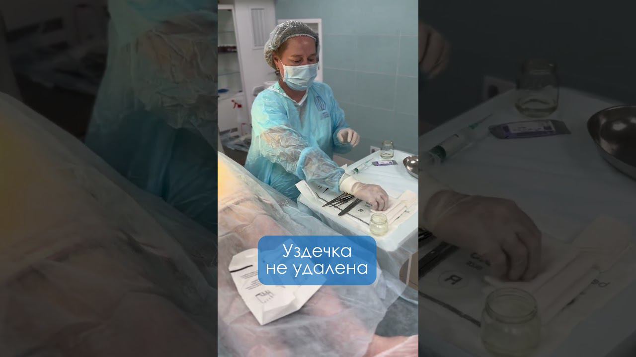 НЕУДАЧНОЕ ОБРЕЗАНИЕ! НУЖНА КОРРЕКЦИЯ! #уролог #shorts  #обрезание #circumcision