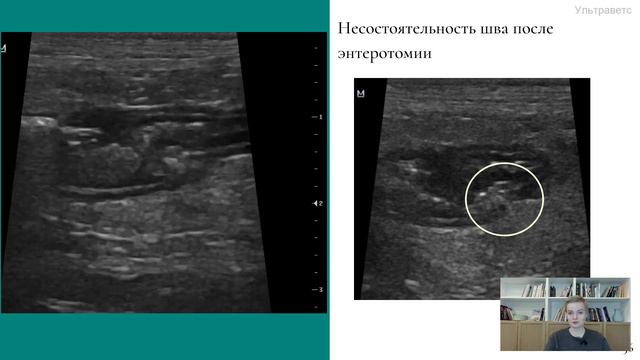 ВНУТРИ КУРСА |УЗИ надпочечников, поджелудочной железы, ЖКТ у собак и кошек |Онлайн-курс УЗИ брюшной