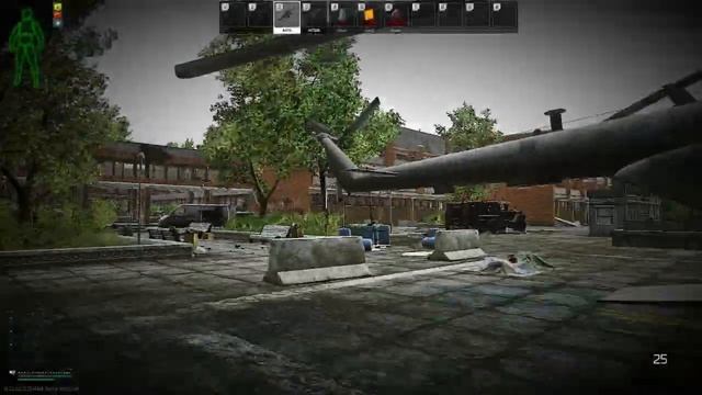 АНЕСТЕЗИЯ.mp4