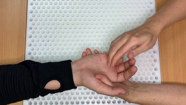 Оценка состояния кисти. Предположительно компрессия в кубитальном канале.