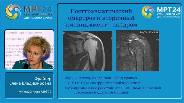 Дифференциальная диагностика заболевания костно-суставной системы по МРТ